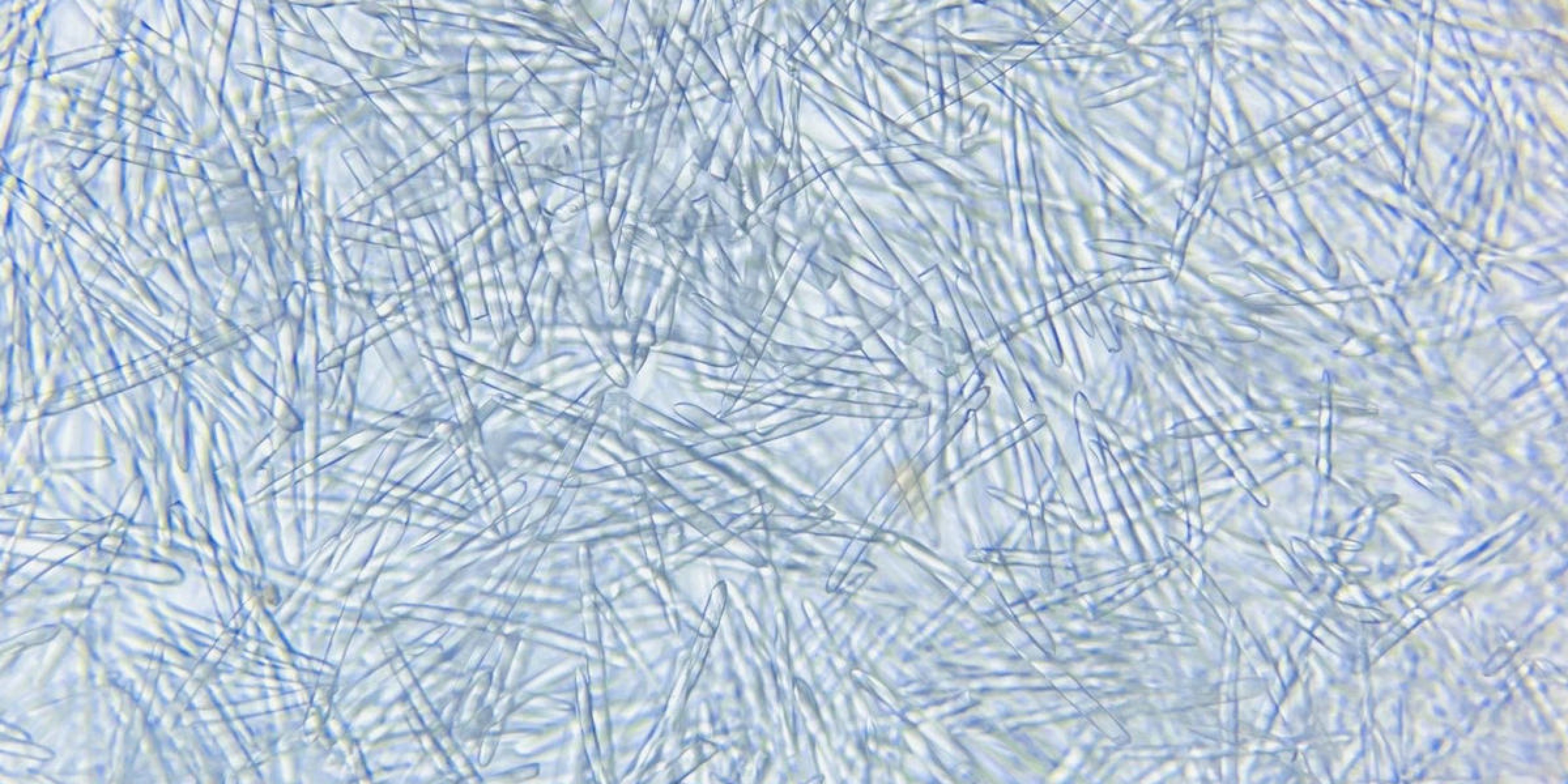 Sponge Spicules | Hydrolyzed Sponge | Spicule Powder | Spongilla ...